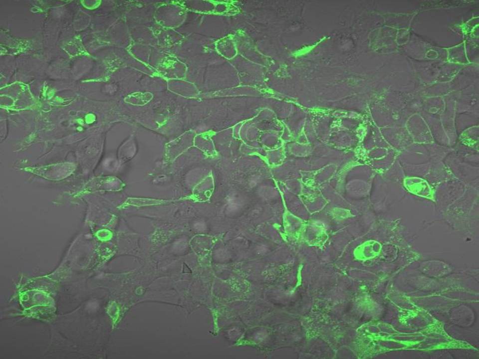 293 (HEK293) - Human Embryonic Kidney Cells - Viability 90 per cent and ...