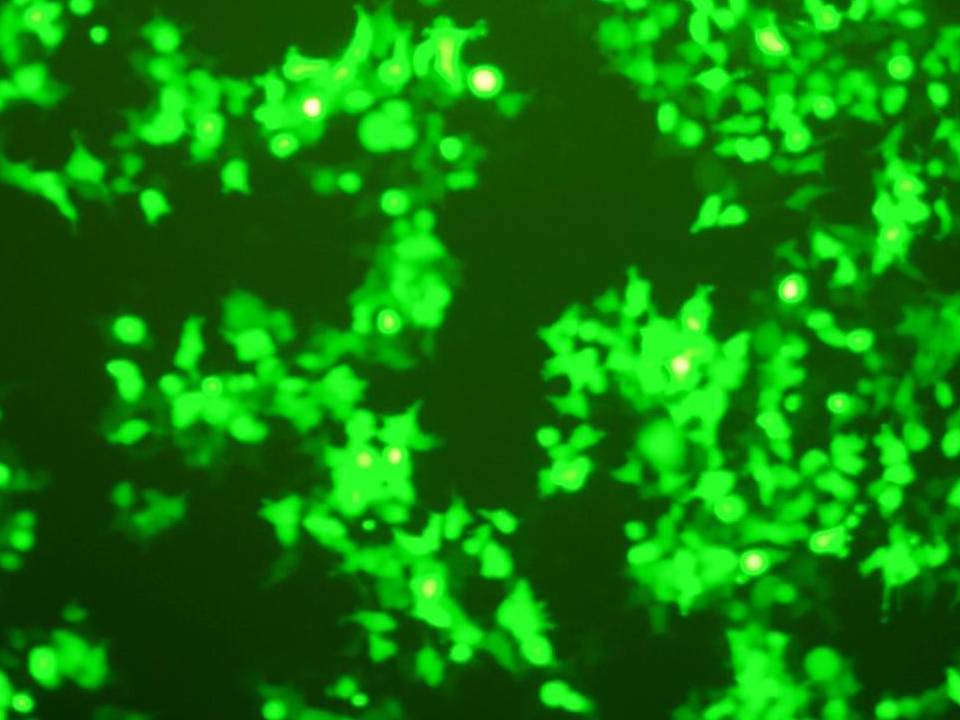 293T (HEK293T) - Human Embryonic Kidney cells - Transfection Efficiency ...