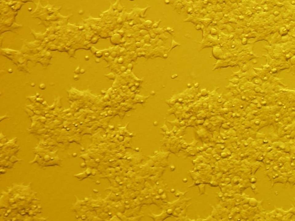 NEPA21 / 293T (HEK293T) - Human Embryonic Kidney cells – Viability 90 ...