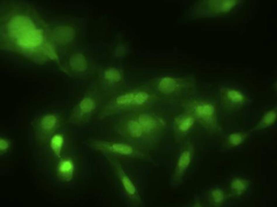 NEPA21 / CHO-K1 - Chinese Hamster Ovary cells - Transfection ...