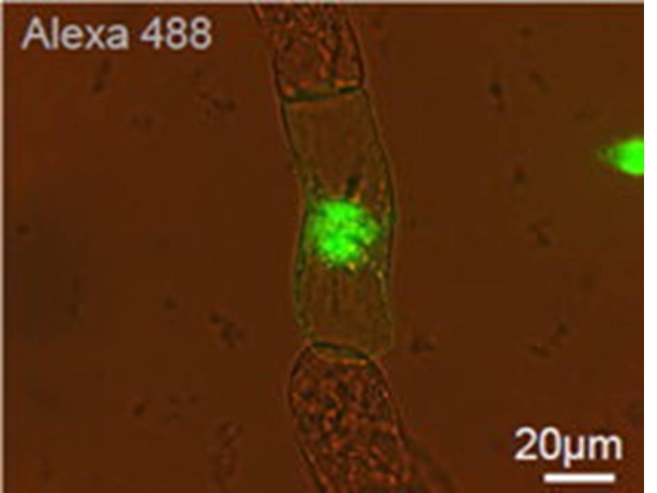 Injection of antibody into plant cells