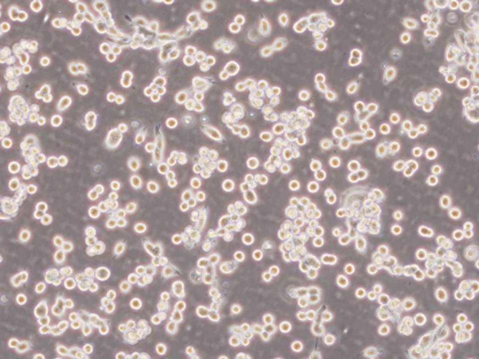 NEPA21 / LLc1 (LL-2) - Mouse Lewis lung cell carcinoma 1 cells ...