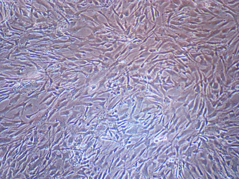 NEPA21 / Primary - Human Mesenchymal Stem cells - Viability 78 per cent