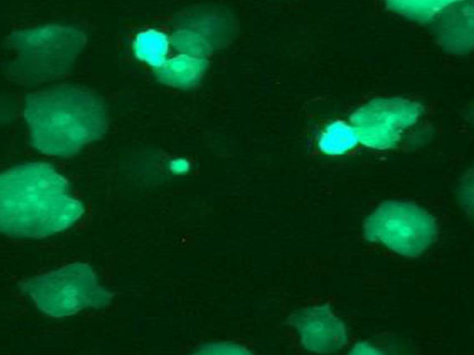 Primary - Mouse Liver cells - Transfection Efficiency 50 per cent.jpg