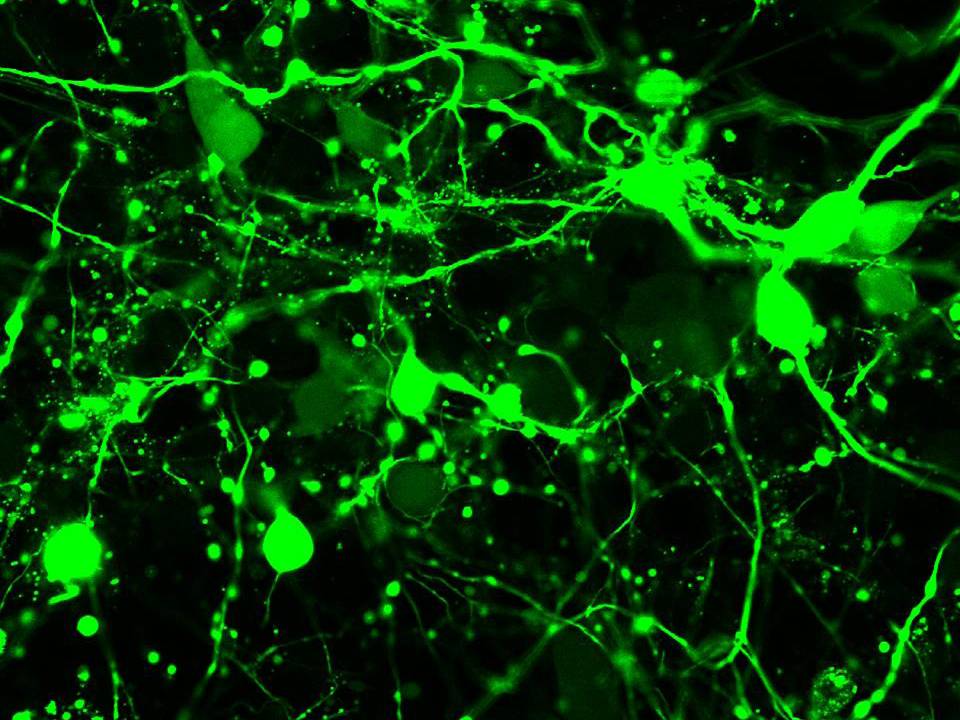 NEPA21 / Primary - Rat Bubblar Neurons - Transfection Efficiency 75 per ...