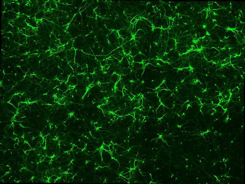 NEPA21 / Primary Mouse Neurons in Adherence2